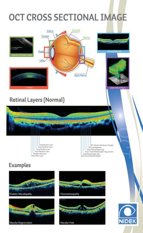 OCT Exam | Optical Coherence Tomographer | Optometrist Langley
